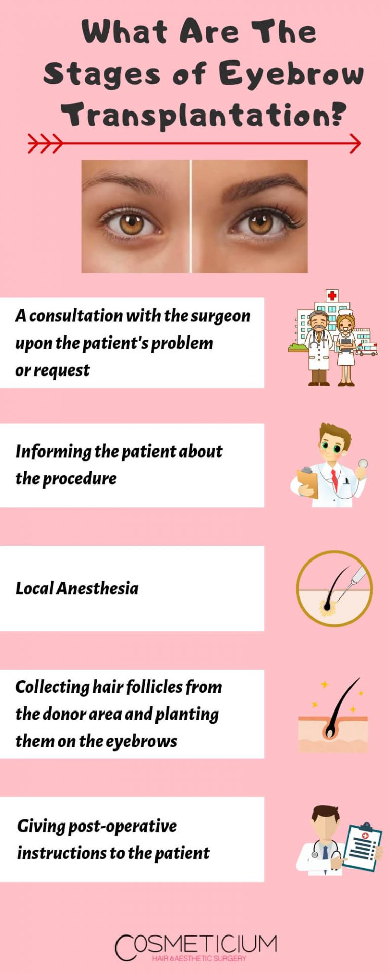 Differences Between Eyebrow Transplantation and Microblading