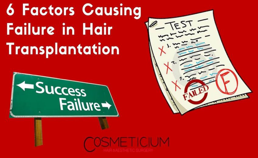 6 Factors Causing Failure in Hair Transplantation - Cosmeticium