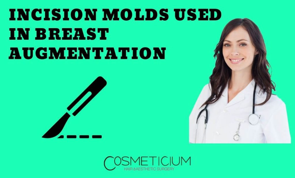 Incision Molds Used in Breast Augmentation and Their Advantages ...