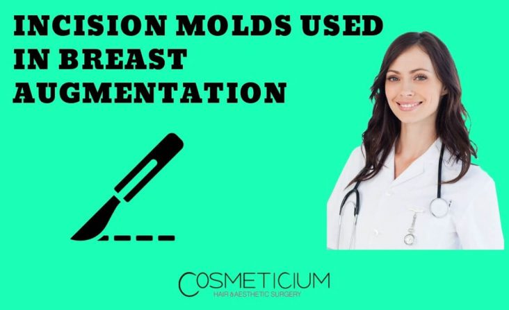 Incision Molds Used in Breast Augmentation and Their Advantages ...