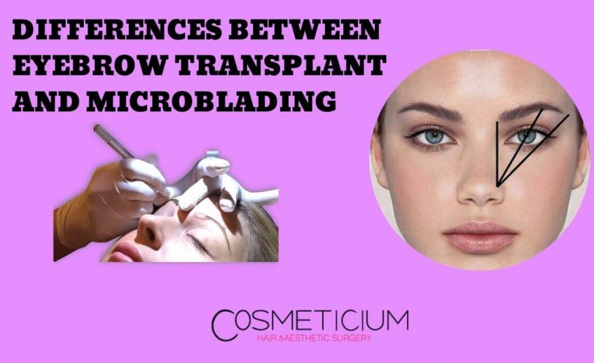 What are the Differences Between Eyebrow Transplantation and Microblading? - Cosmeticium
