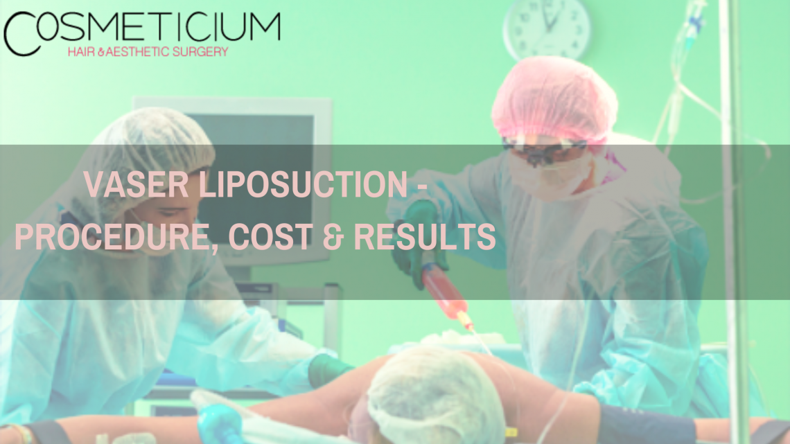 Vaser Liposuction - Procedure, Cost & Results | Cosmeticium
