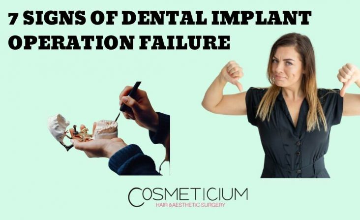 7 Signs of Dental Implant Operation Failure - Cosmeticium