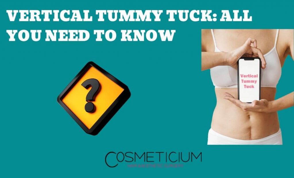 Vertical Tummy Tuck: All You Need to Know - Cosmeticium