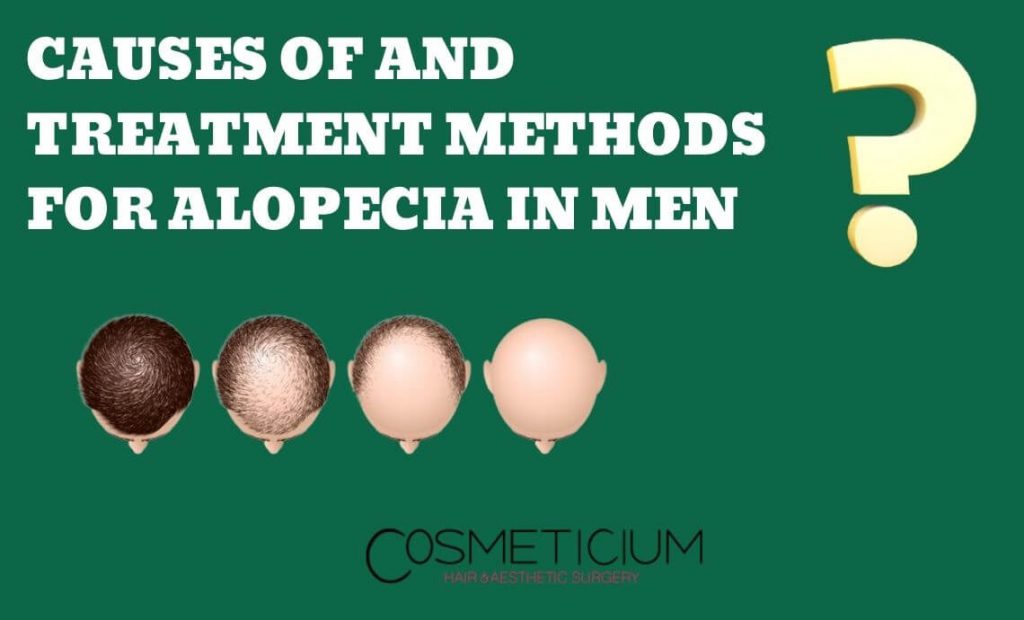 Causes of and Treatment Methods for Alopecia in Men - Cosmeticium