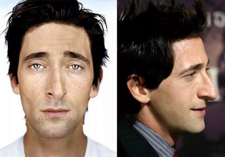 Different Types of Noses Shapes in Different Ethnicity