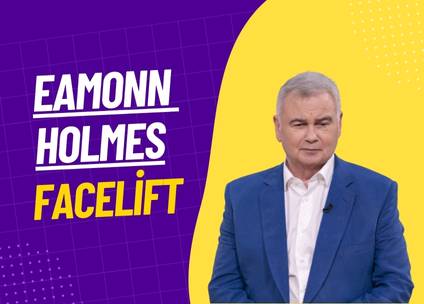 Eamonn Holmes Facelift: A Closer Look