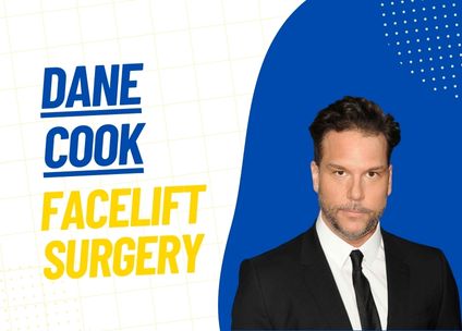 Dane Cook's Facelift: A Detailed Examination - Cosmeticium
