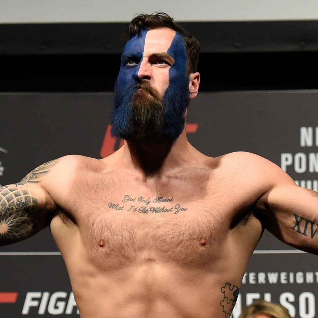 Paul Craig: A Hair Transplant Journey - Cosmeticium