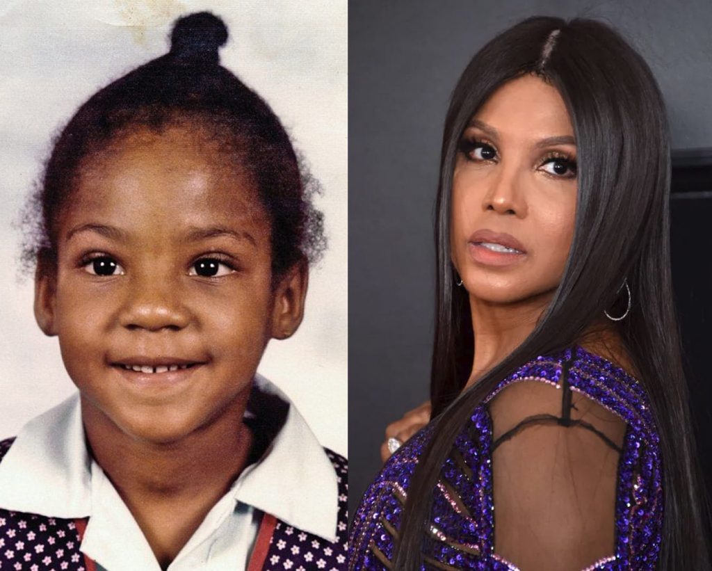 Toni Braxton Nose Job - Cosmeticium